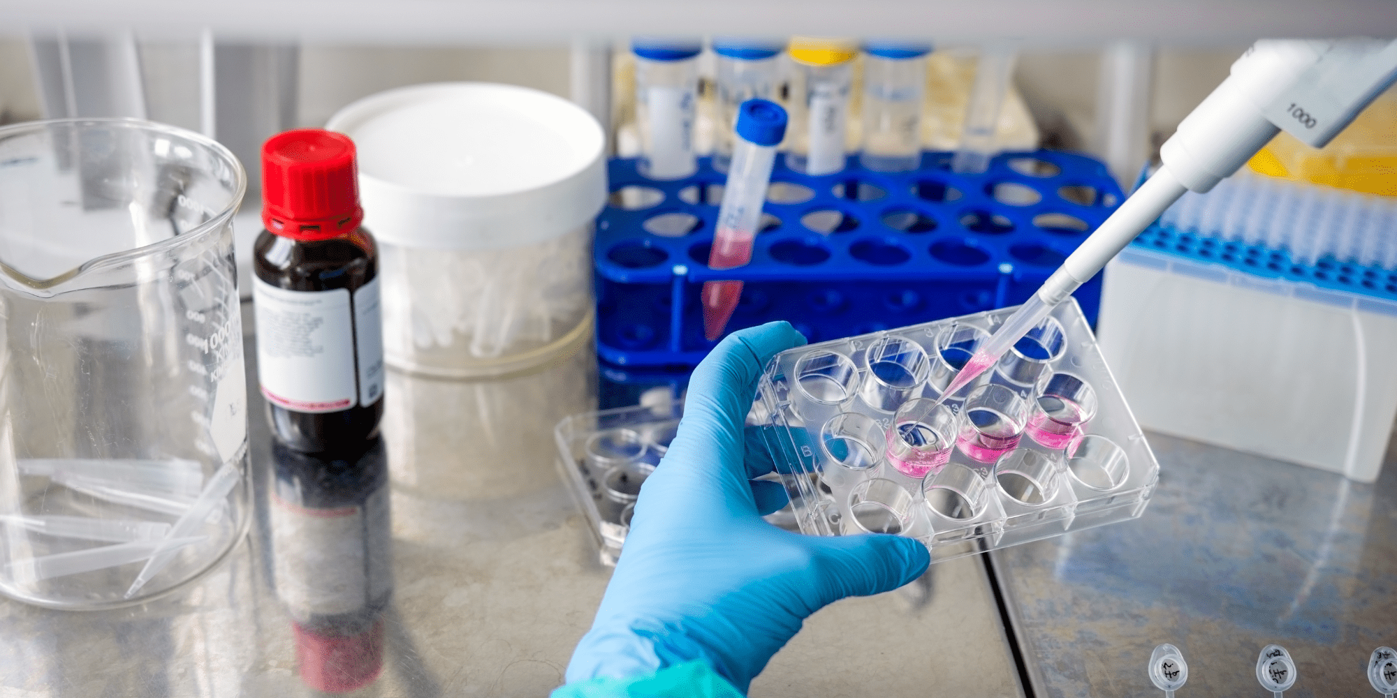 Rare and Complex Diseases - Novogene